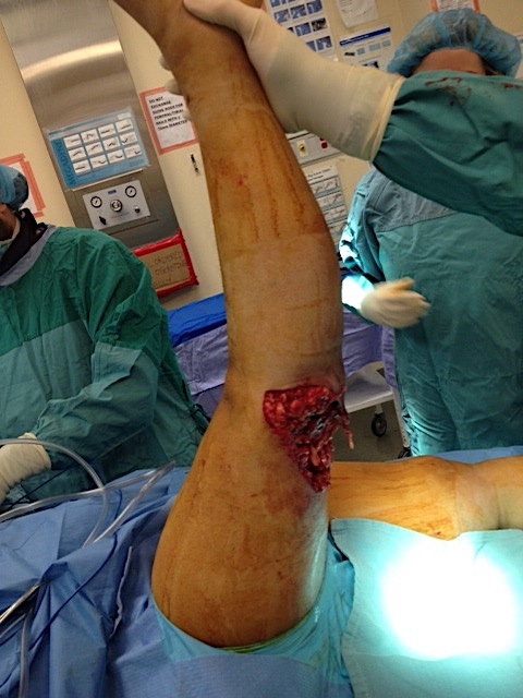 Background | The Bone School